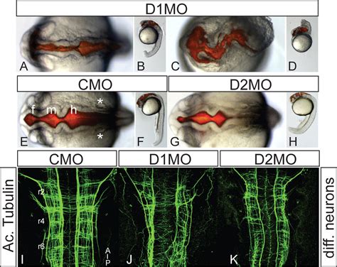 Understanding the Role of DISC1 in Psychiatric Disease and during ...