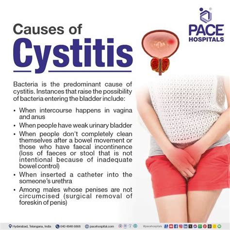 Cystitis Types Symptoms Causes Prevention And Treatment