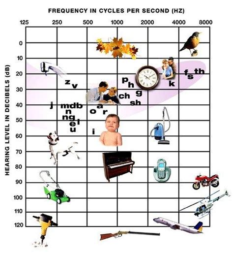 An Easy Guide To Reading Your Audiogram With Pictures And Illustrations