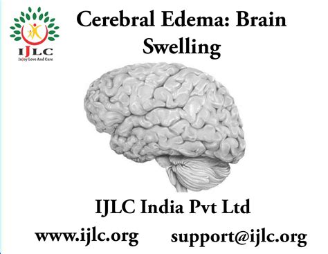 Ijlc India Private Limited Cerebral Edema Brain Swelling Cerebral Edema Or Brain Swelling