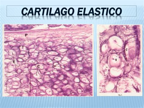 Ppt Tejido EsquelÉtico Powerpoint Presentation Free Download Id