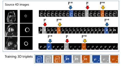1 Our Strategy To Train A Segmentation Forest From 3dt Cardiac Data