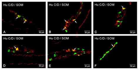 Intramural Plexuses In The Large Intestine Part Expressing Som