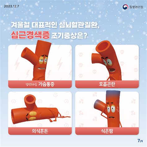 겨울철 불청객 ‘심뇌혈관질환조기증상 및 예방법은