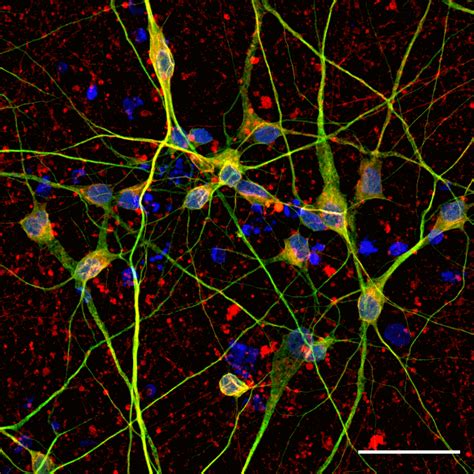 Dapt Neural Stem Cells Tocris Bioscience