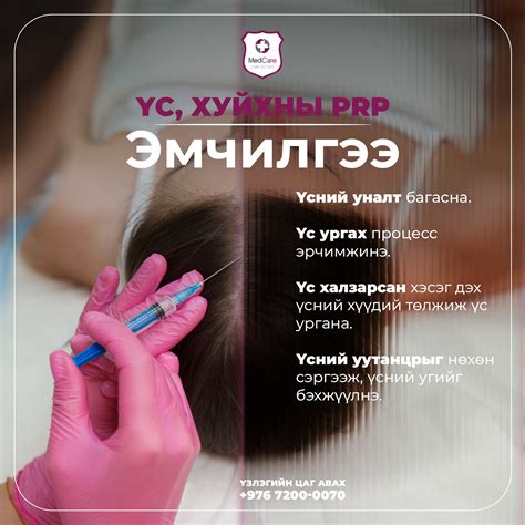 Эмэгтэйчүүдийн нөхөн сэргээх мэс засал