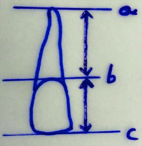 A B Root Length Rl B C Crown Height C Root Crown Ratio Rl