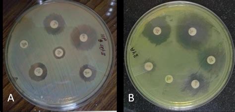 Antibiotic Susceptibility Testing Using Disc Diffusion Method A E