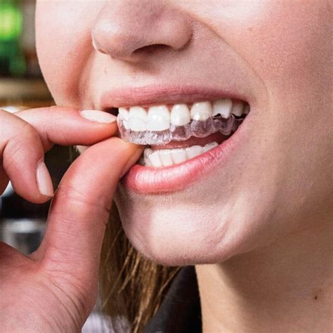 What Things Should You Not Do While Wearing Metal Braces World Of