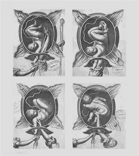 How Sketches Of The Womb Have Empowered And Oppressed Women Over The