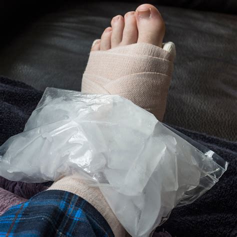 Pigmented Villonodular Synovitis Treatment Wetreatfeet