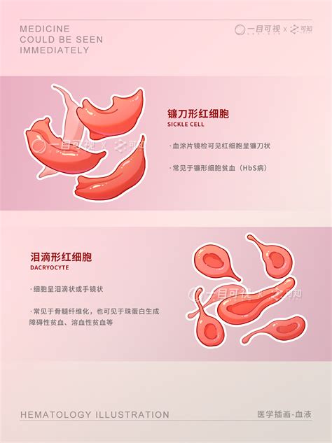 血液系统 红细胞异常形态 知乎