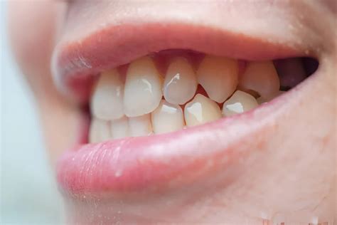 What Are Cuspid Teeth A Complete Guide