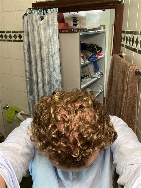 Anything For Women That Seems To Work As Well As Finasteride Does For