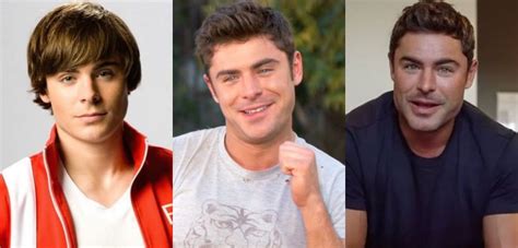 Zac Efron explicó el drástico cambio que experimentó su rostro sufrió accidente doméstico