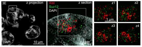 Polycomb Recruitment In X Chromosome Inactivation Alchetron The Free