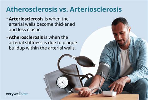 How Atherosclerosis Vs Arteriosclerosis Affect Artery