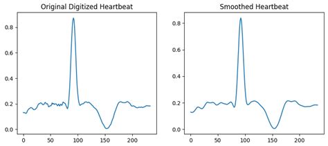 Sensors Free Full Text Cardiac Arrhythmia Classification Using