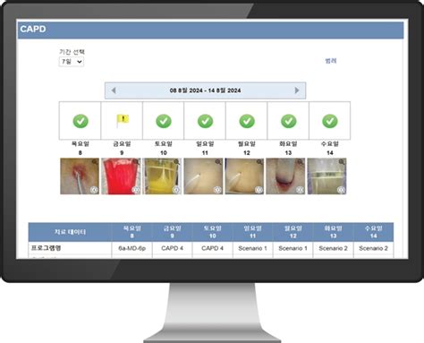 박스터 재택 복막투석 관리 앱 ‘마이피디 포토캡쳐 기능 추가