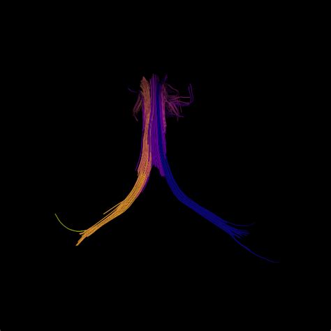 Tractography Clustering Available Features — Dipy 1110 Documentation