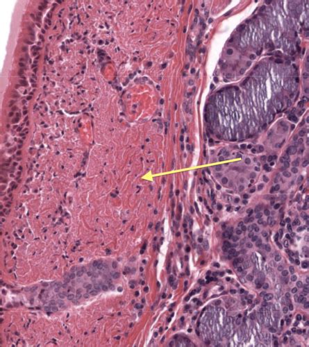 Respiratory Histo Photos Flashcards Quizlet