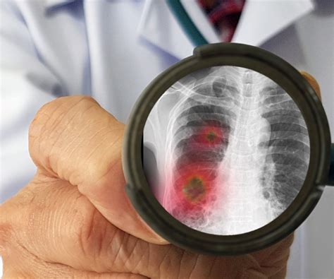 Infection Screening Package Best 247 Clinic In Dubai Al Noor