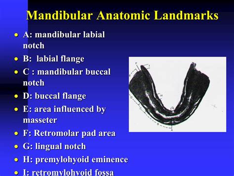 Ppt Anatomy Of Mandibular Denture Bearing Area Powerpoint