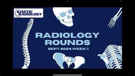 Radiology Case Rounds Steida Process Acl Rupture Meniscal Tears