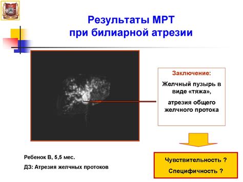 Пороки развития и заболевания желчных протоков и желчного пузыря у