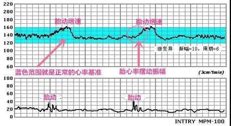 胎心监护“宝宝的生命线”，孕妈们可别偷懒 杭州美中宜和妇儿医院【官网】杭州高端妇产医院杭州月子会所杭州妇保医院 美中宜和医疗