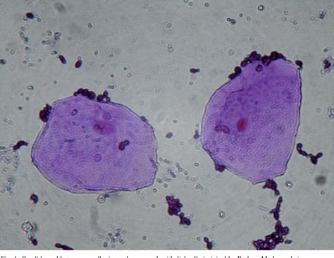 Figure 1 From Adherence Of Candida Sp To Host Tissues And Cells As One