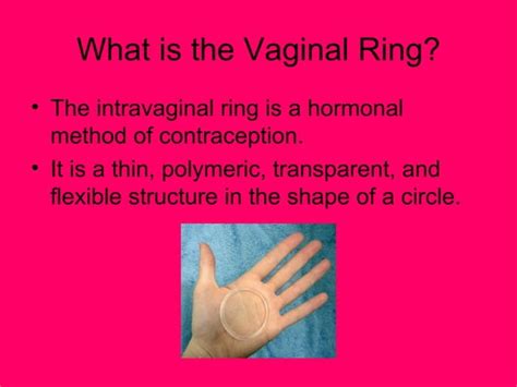 Forms Of Contraception Ppt