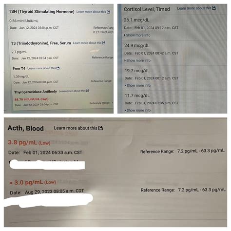 Do I Pursue Pituitary Issues Rdiagnoseme