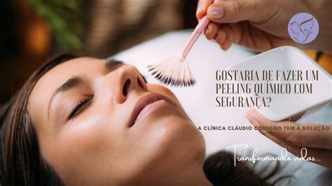 Peeling químico segurança Saiba mais