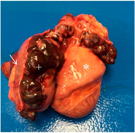 What Causes Hemangiosarcoma Of The Heart In Dogs