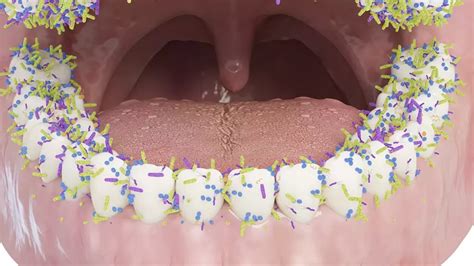 10 Health Benefits Of Having A Probiotic Oral Microbiome Leeming Dental