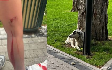 არავინ გამოხტეს ახლა ძაღლების უფლებადამცველი 10 წლის ბიჭს სამმა ძაღლმა ხორცები გამოაგლიჯა