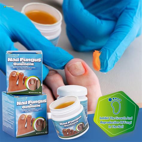 Paronychia Ointment Toenail Care Cream For Brittle Sinking Cloudy Thick