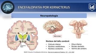 Kernicterus Pptx