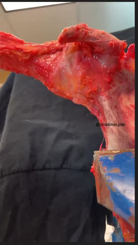 💥𝐅𝐢𝐛𝐮𝐥𝐚𝐫𝐢𝐬 𝐌𝐮𝐬𝐜𝐥𝐞 𝐌𝐨𝐛𝐢𝐥𝐢𝐳𝐚𝐭𝐢𝐨𝐧💥 —— 📚the Fibularis Muscles Fibularis