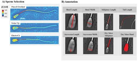 Slim Density Images Panel A Of Sperm Selected By The Three Separation