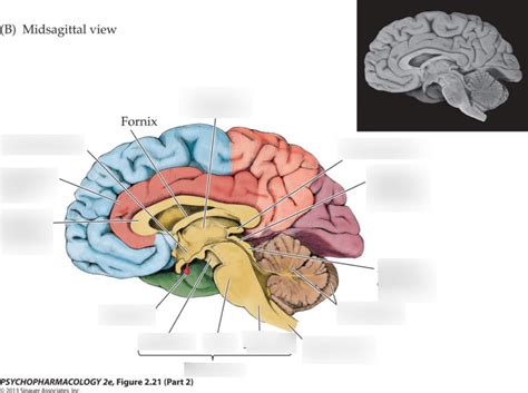 Midsagittal View Diagram Quizlet