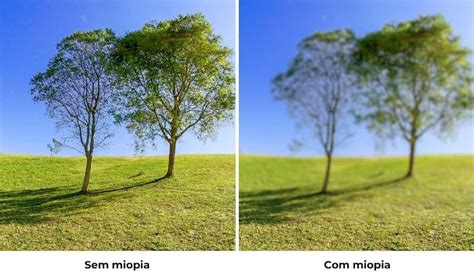 Tudo O Que Você Precisa Saber Sobre Miopia Central Da Visão