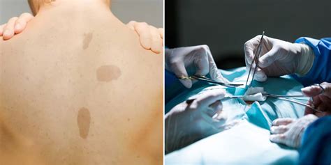 Woman In China Dies After Undergoing Multiple Cosmetic Procedures To