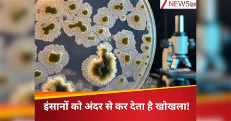 Deadly Drug Resistant Fungus Aspergillus Fumigatus Spreading Fast