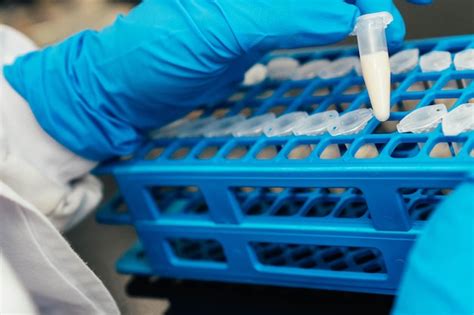 Premium Photo A Gloved Hand Holds An Eppendorf Tube With A Sample