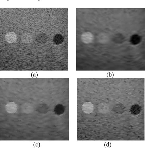 Figure 1 From Adaptive Pyramid Filtering For Medical Ultrasound Image Enhancement Semantic Scholar