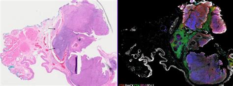 From Pixels To Biological Insights Spatial Multiomic Phenotyping