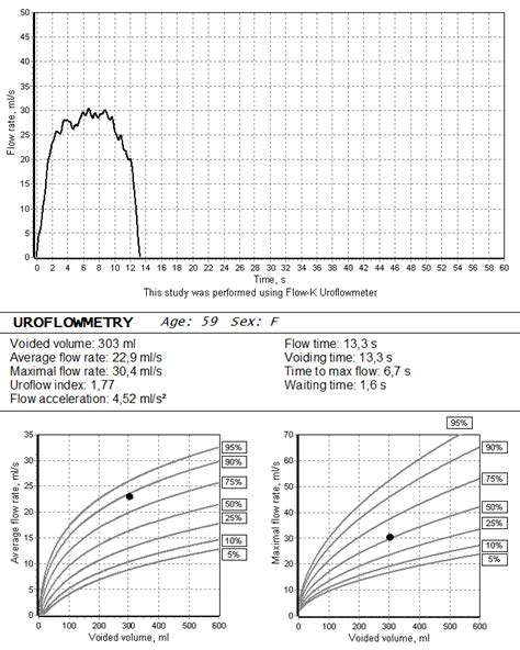 Normal Flow K Uroflowmeter
