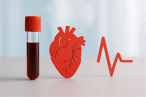 The 2025 Levels Guide To Cardiac Health Tests Levels Levels
